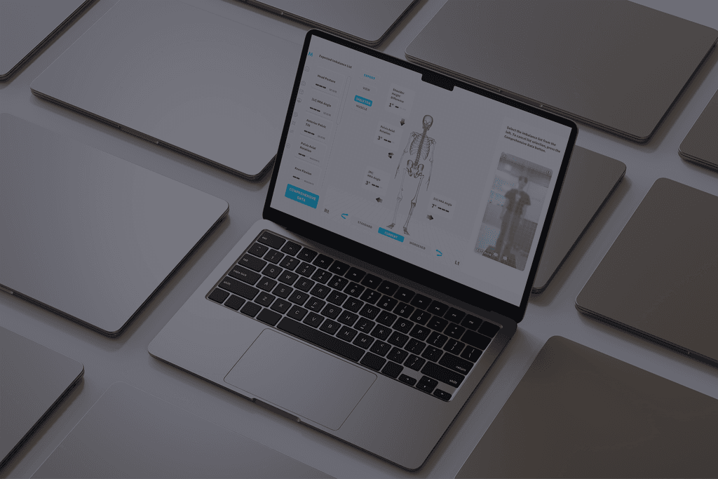 Moti Physio | 3D Posture Analyzer